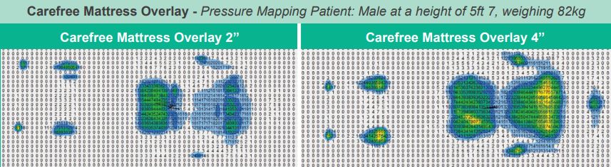 Carefree Modular Cut Pressure Relief Mattress Overlay | Hospital Beds